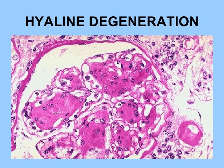 General pathology lecture 1 introduction & cell injury