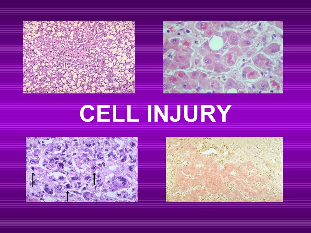 General pathology lecture 1 introduction & cell injury