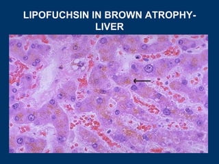General pathology lecture 2 intracellular accumulations | PPT