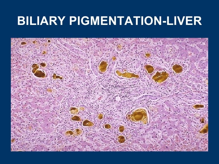 General pathology lecture 2 intracellular accumulations