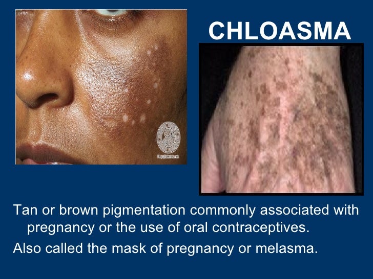 General pathology lecture 2 intracellular accumulations