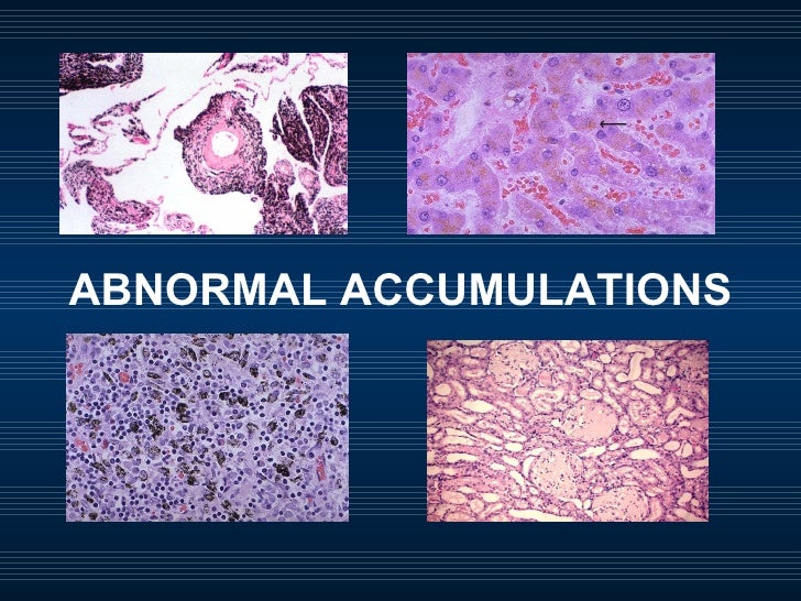 General pathology lecture 2 intracellular accumulations