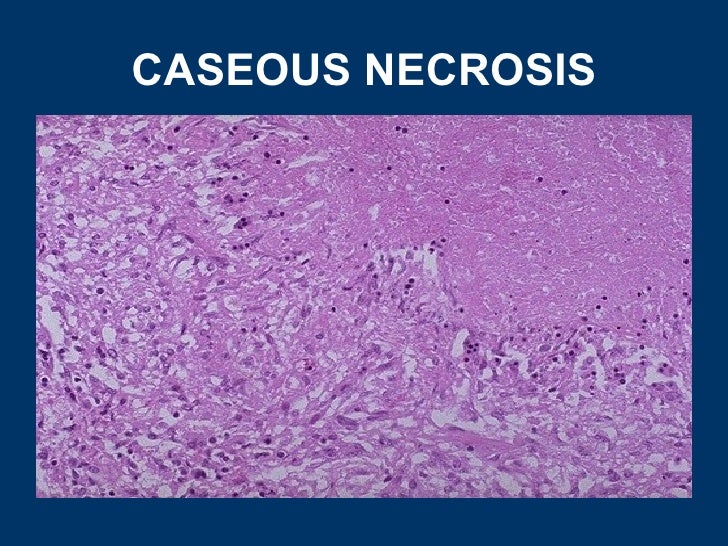 General pathology lecture 3 cell death or necrosis