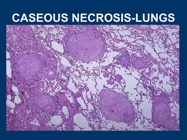 General pathology lecture 3 cell death or necrosis | PPT