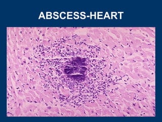 General pathology lecture 3 cell death or necrosis | PPT