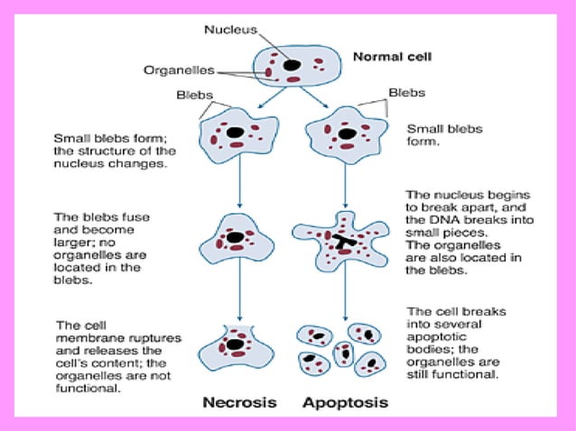 General pathology lecture 3 cell death or necrosis | PPT