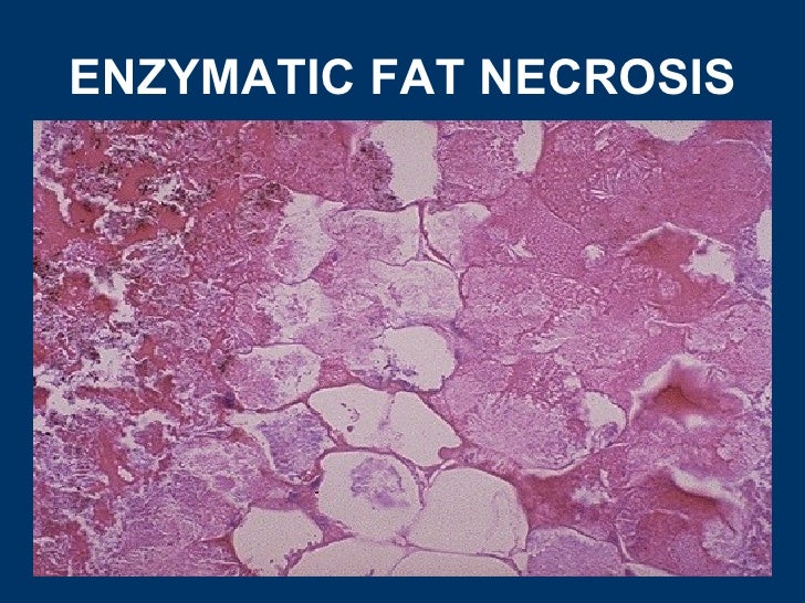 General pathology lecture 3 cell death or necrosis