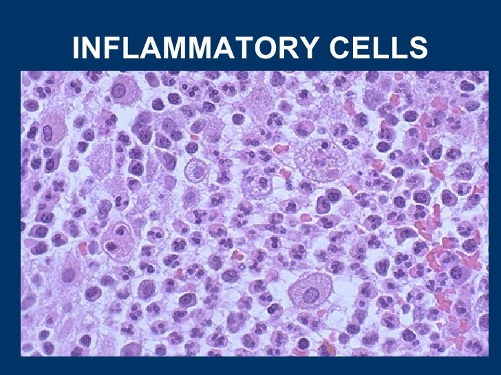 General pathology lecture 5 inflammation & repair
