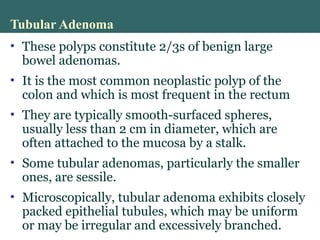 General pathology lecture 6 adenoma | PPT