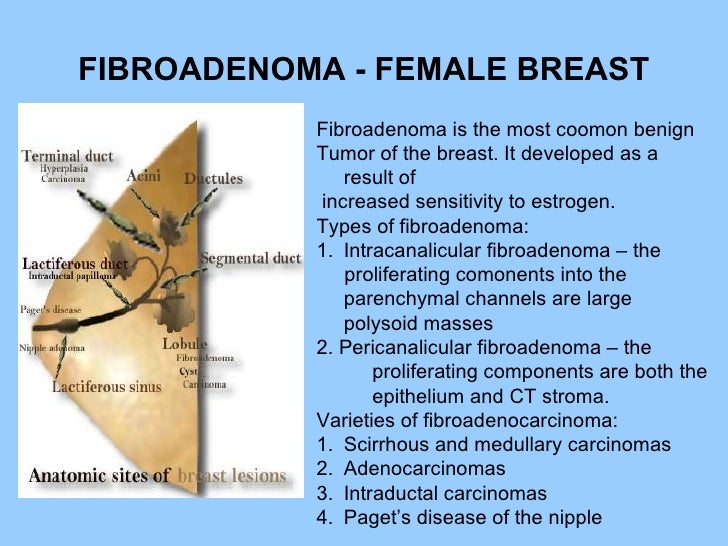 General pathology lecture 7 neoplasms