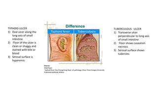 General Pathology of Infections and Acute Bacterial Infections 23_5_23.pptx