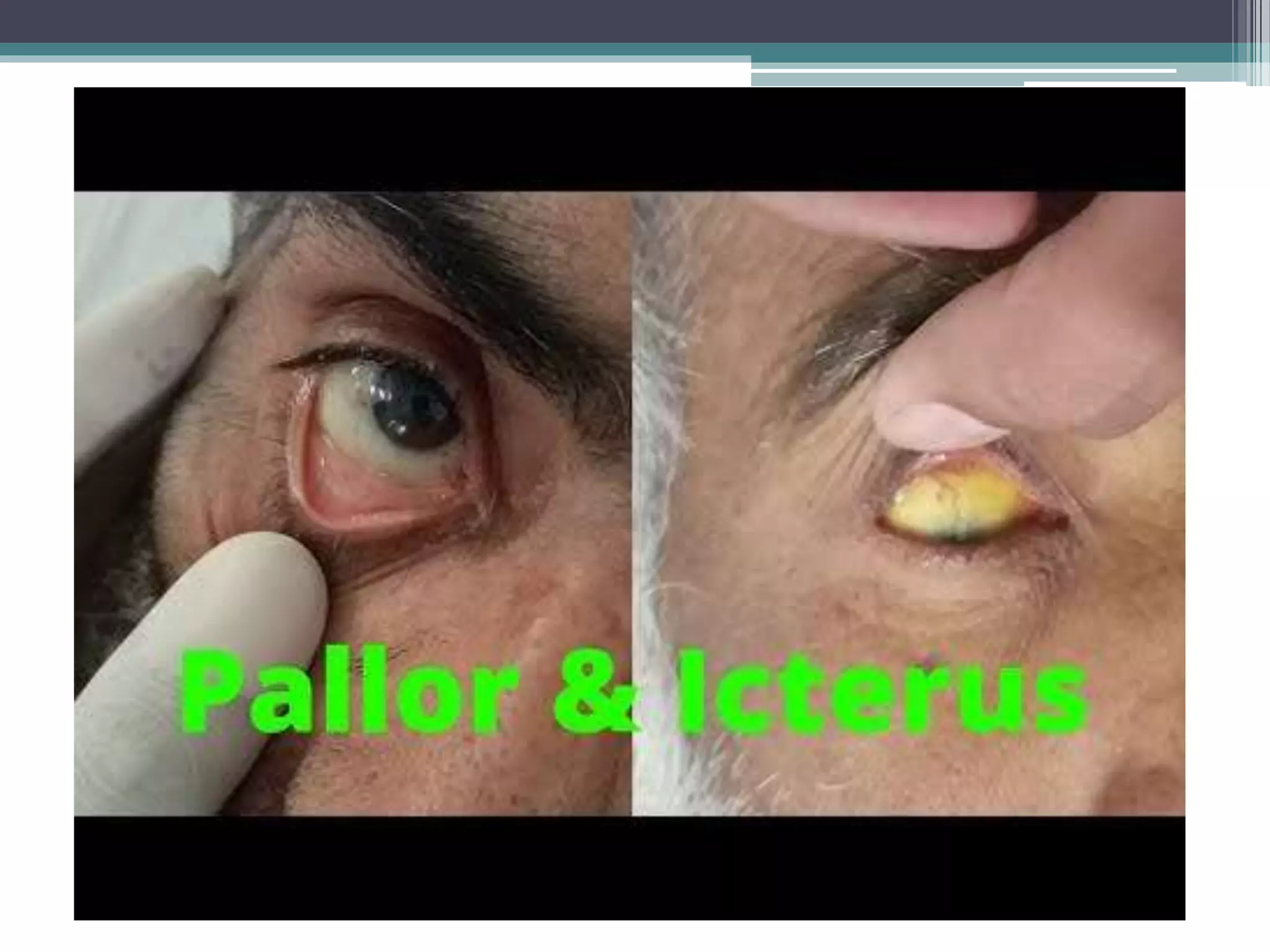 General, Physical And Systemic Examination.pptx