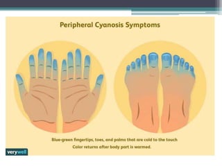 General, Physical And Systemic Examination.pptx