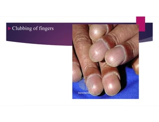 General physical examination-1.Bsc nursing | PDF