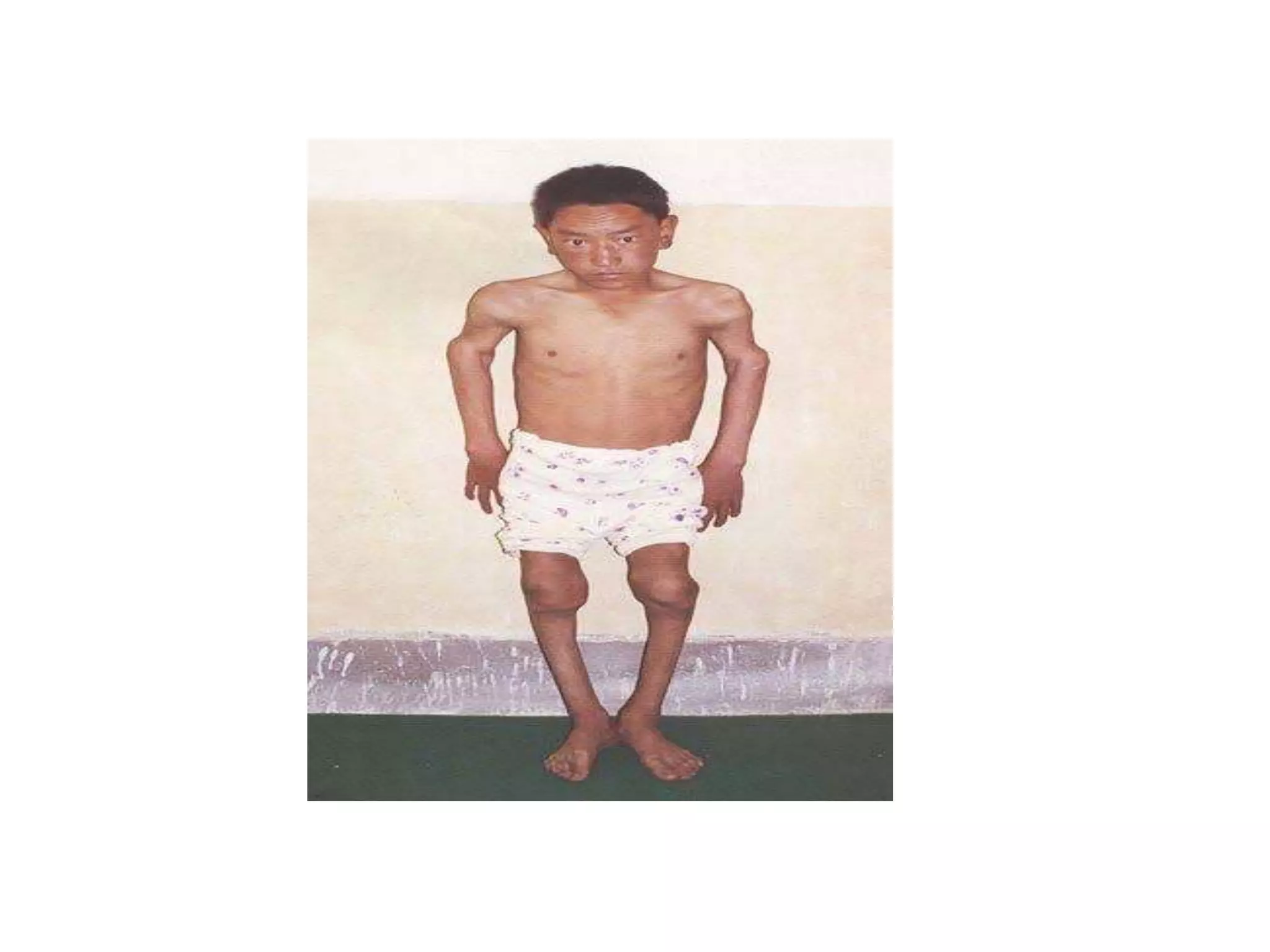 General Physical Examination - Importance in Practice | PPTX