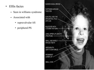 General physical examination of CVS | PPTX