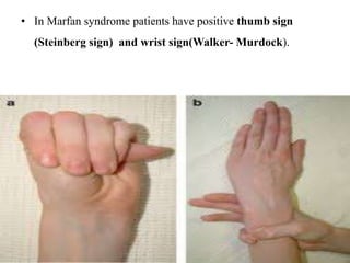 General physical examination of CVS | PPT