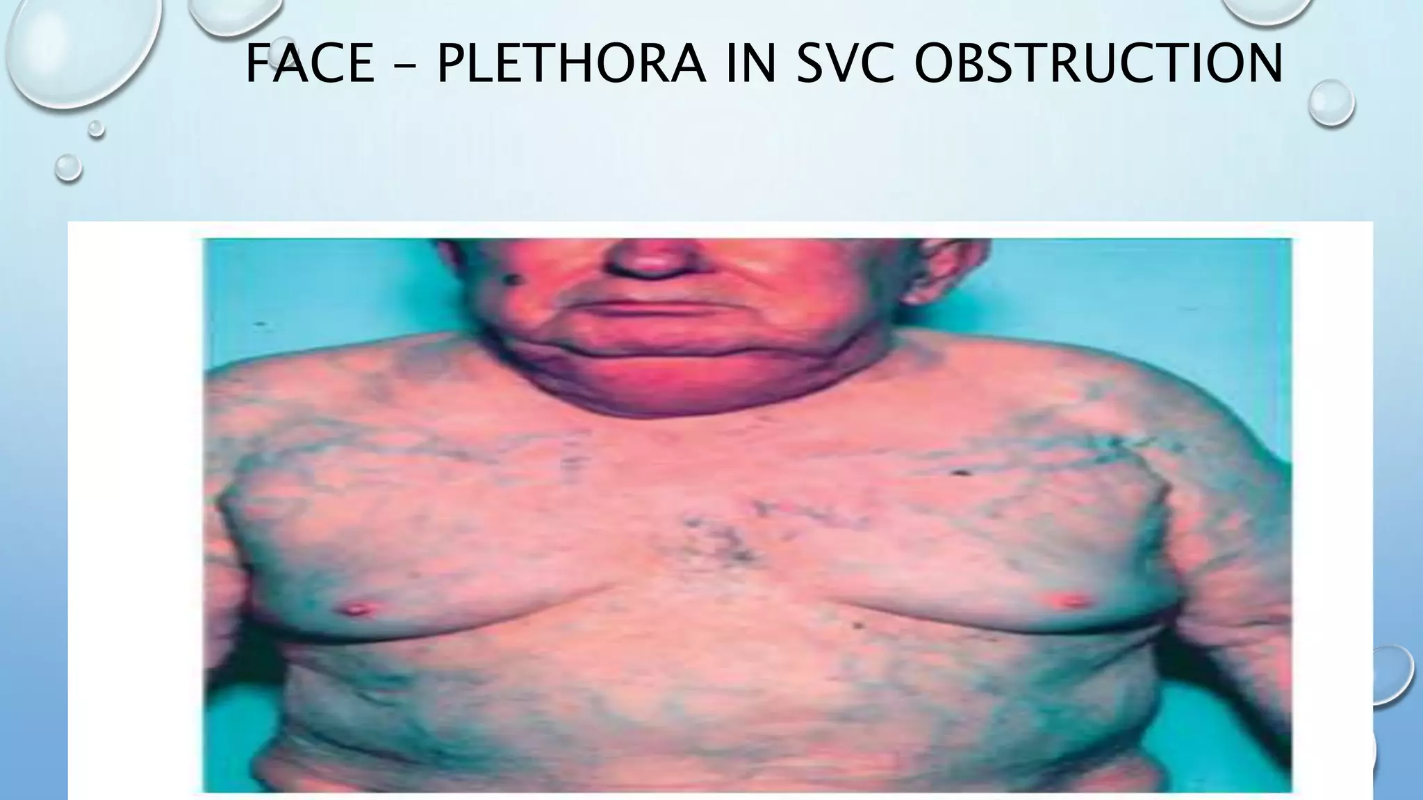 General physical examination of the respiratory system | PPTX