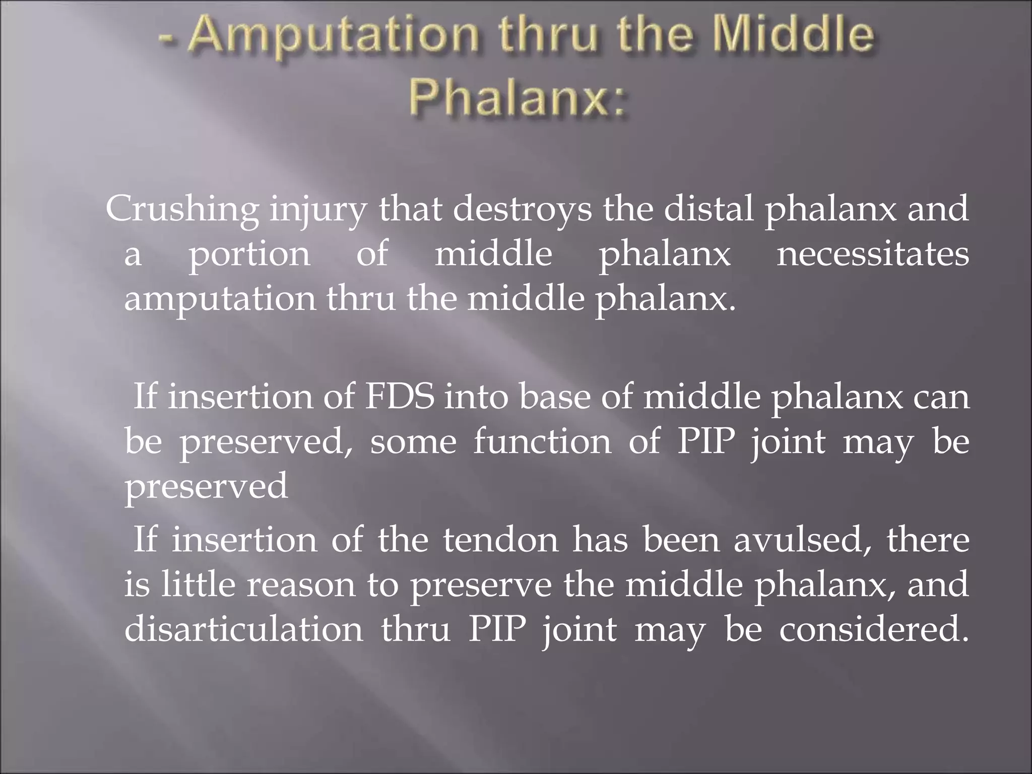 General Principales of Amputation in limb.ppt