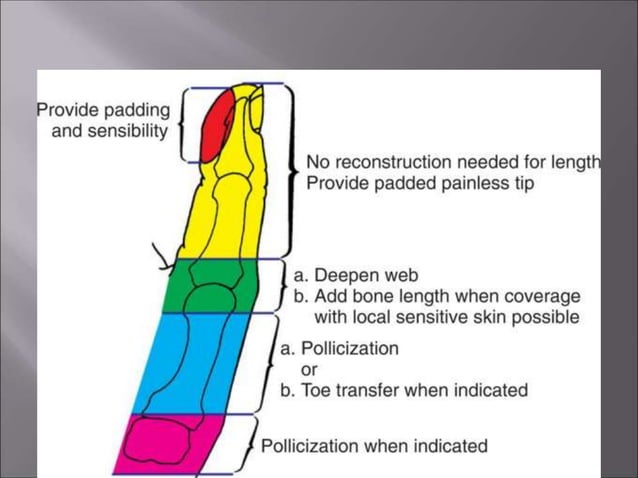 General Principales of Amputation in limb.ppt