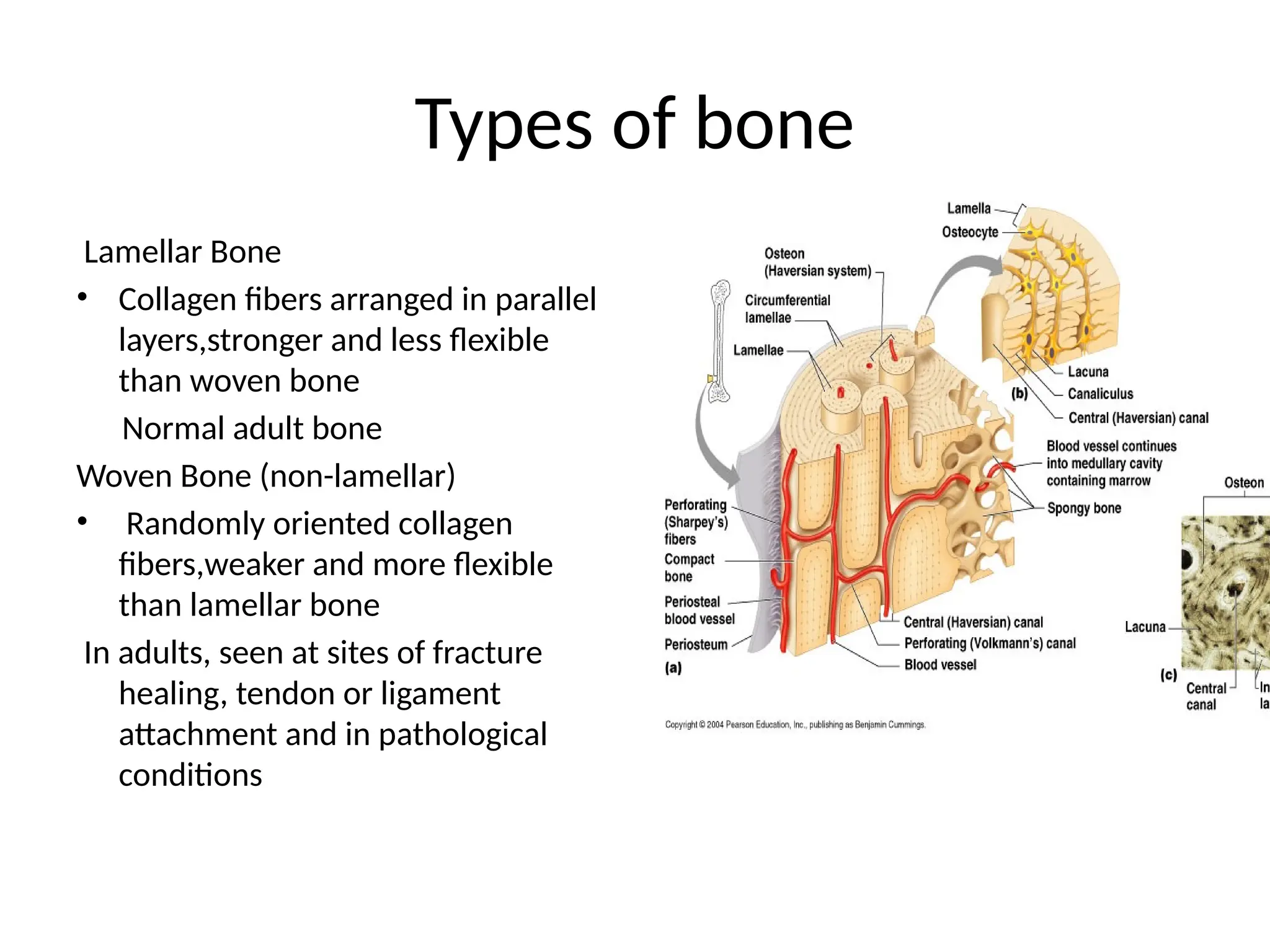 General principle of fracture & dislocation,solomon.pptx