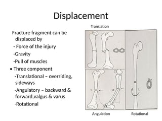 General principle of fracture & dislocation,solomon.pptx