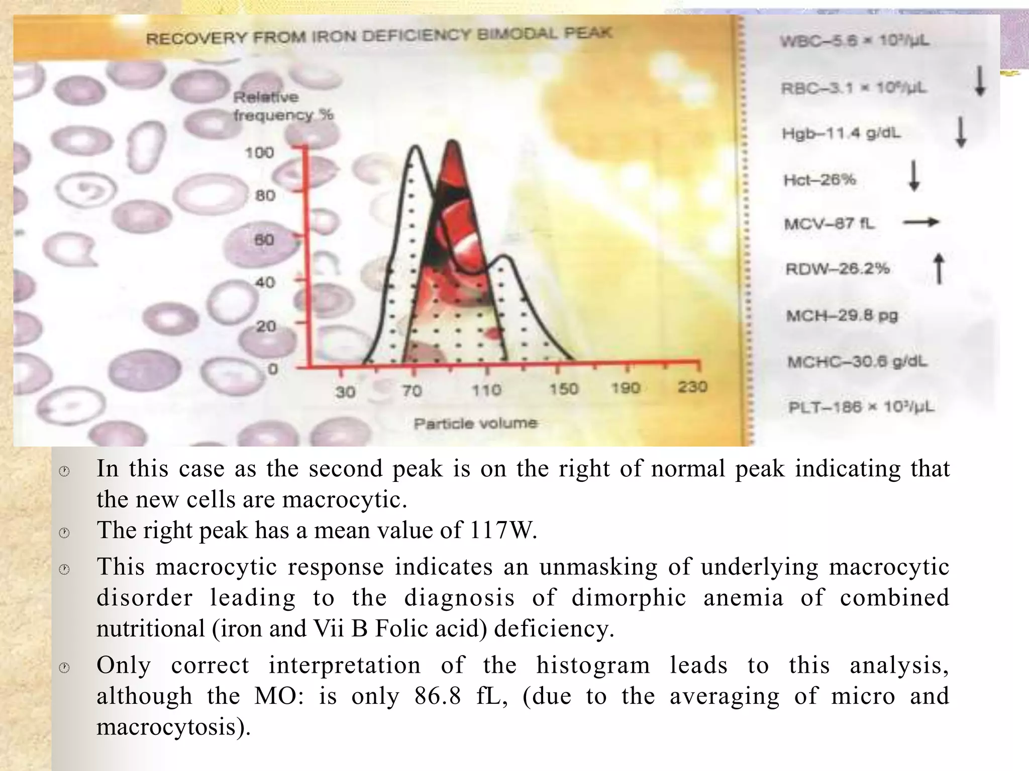 Interpretation of cbc 3 | PPTX | Blood Disorders | Diseases and Conditions