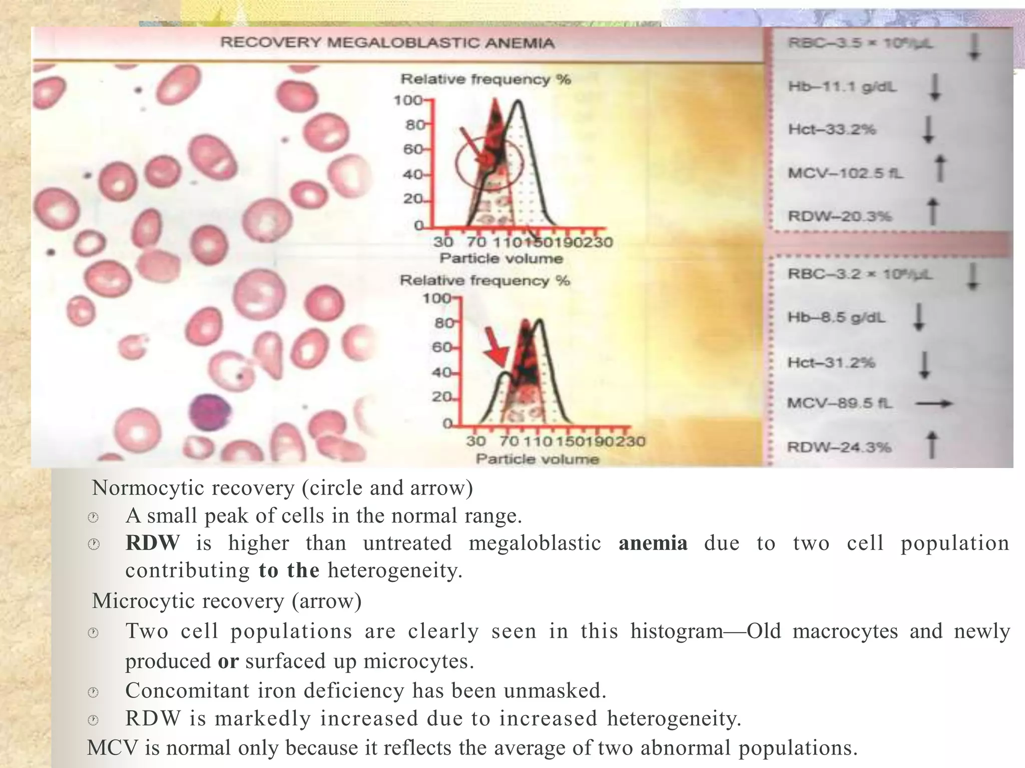 Interpretation of cbc 3 | PPTX | Blood Disorders | Diseases and Conditions