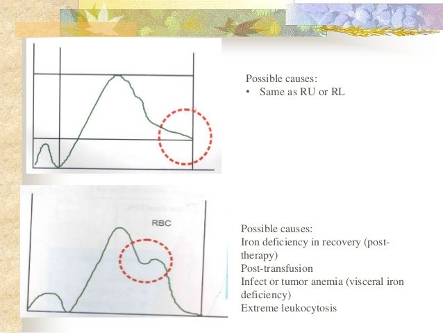 Interpretation of cbc 3