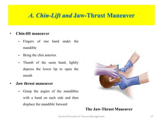 General Principle of Trauma Mgt.pptx