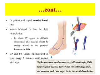 General Principle of Trauma Mgt.pptx