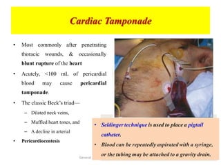 General Principle of Trauma Mgt.pptx