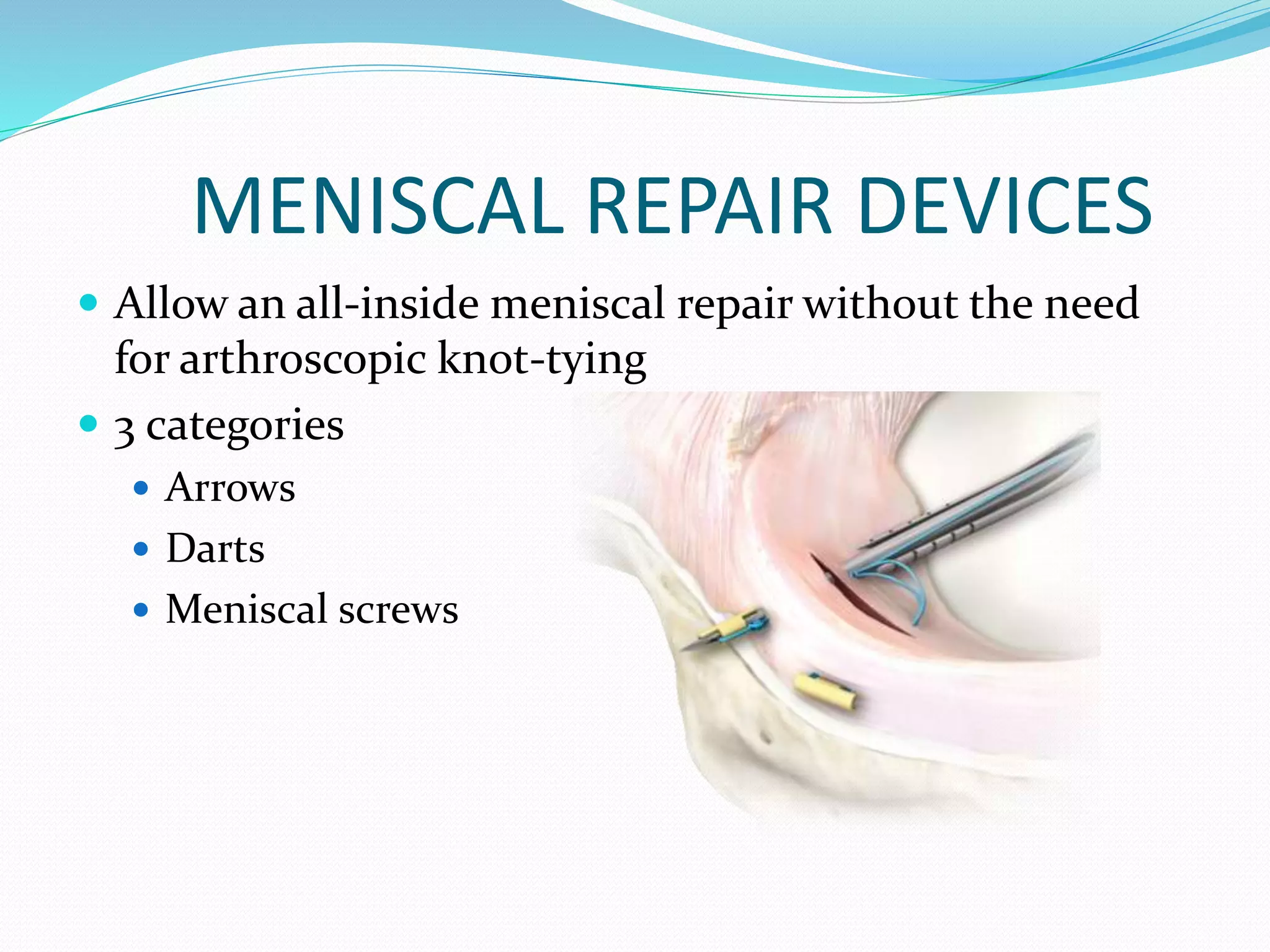 General Principles Of Arthroscopy Kle Belgaum Dr Utkarsh Dwivedi Ppt