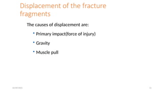 General principles of fracture and dislocation | PPTX