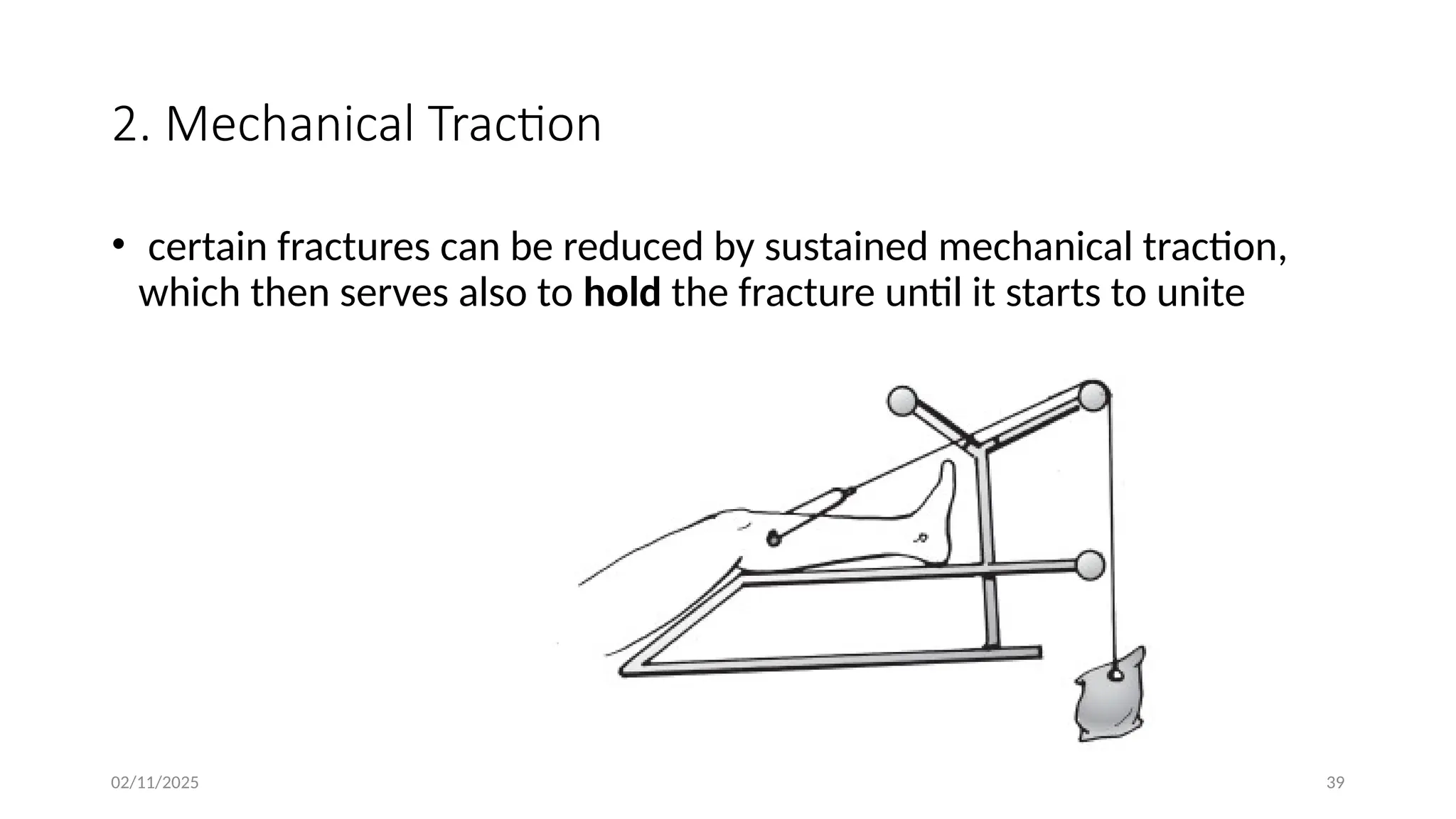 General principles of fracture and dislocation (2).pptx