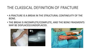 GENERAL_PRINCIPLES_OF_FRACTURE_MANAGEMEN.pptx