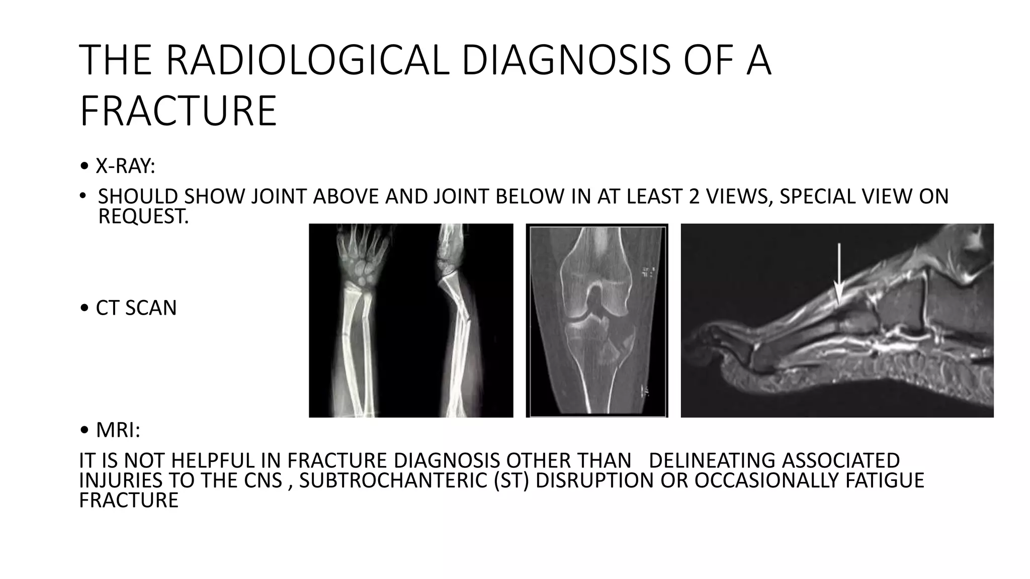 GENERAL_PRINCIPLES_OF_FRACTURE_MANAGEMENT.ppt
