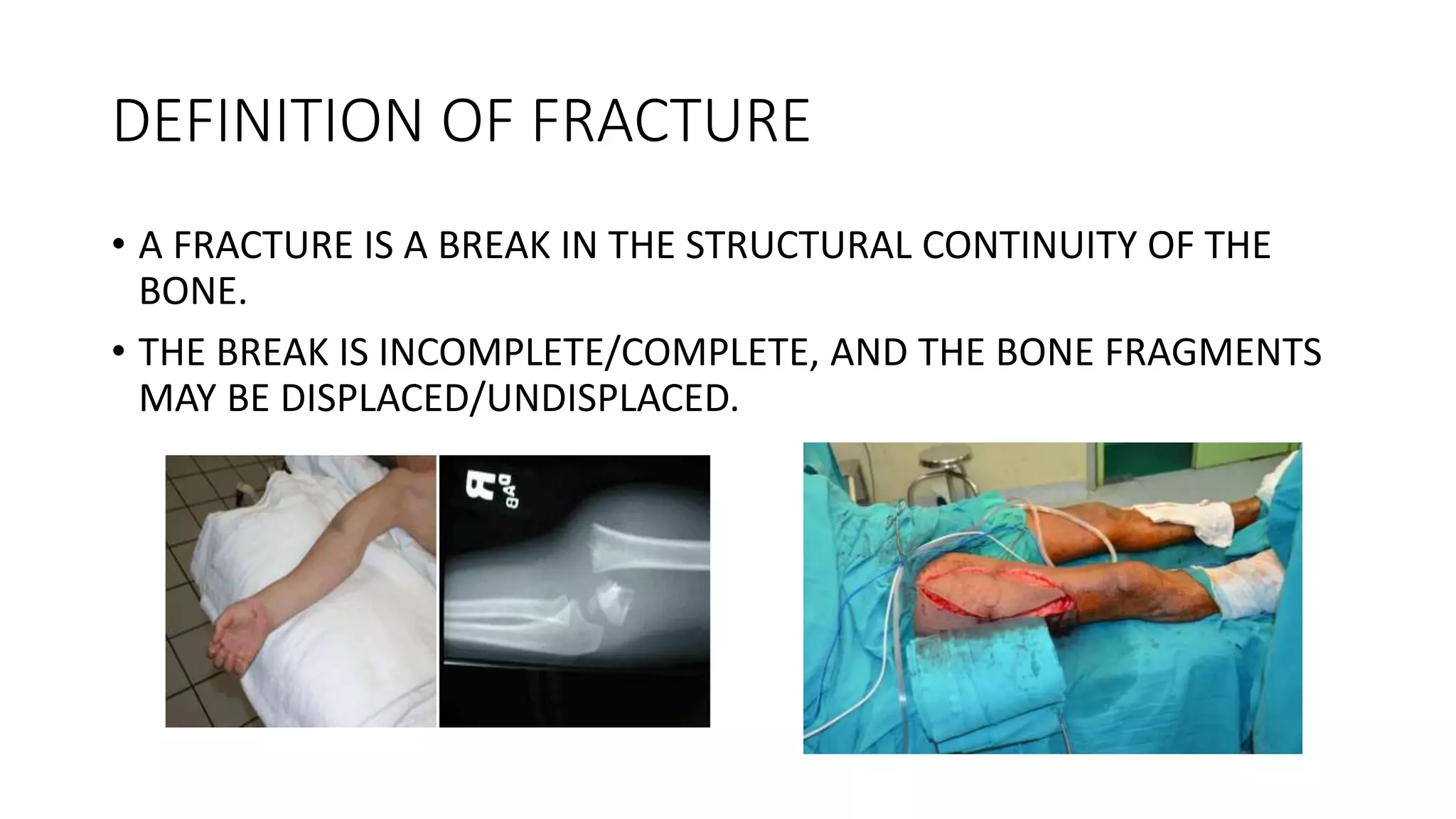 GENERAL_PRINCIPLES_OF_FRACTURE_MANAGEMENT.ppt