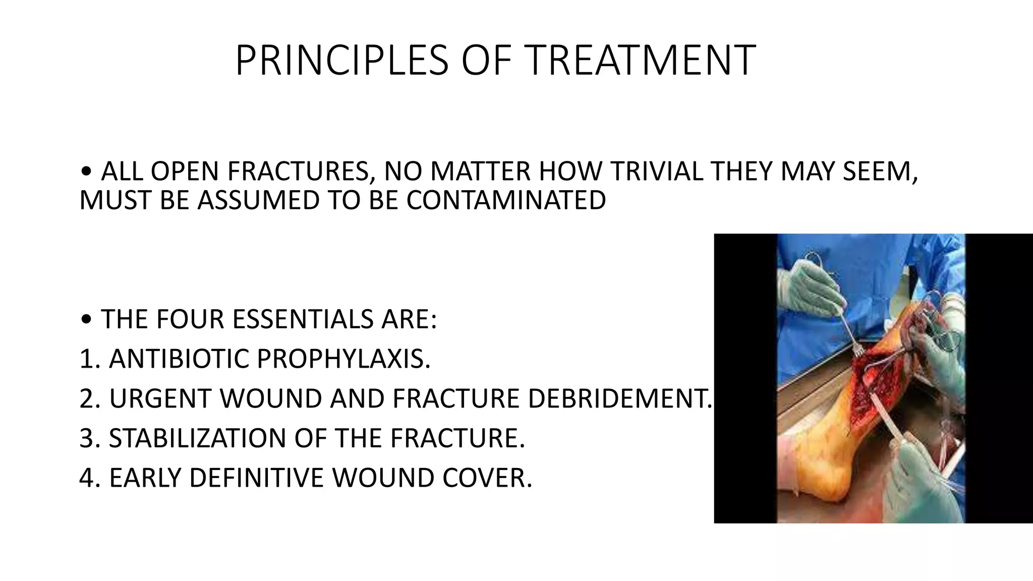 GENERAL_PRINCIPLES_OF_FRACTURE_MANAGEMENT.ppt
