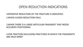 GENERAL_PRINCIPLES_OF_FRACTURE_MANAGEMENT.ppt