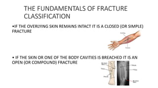 GENERAL_PRINCIPLES_OF_FRACTURE_MANAGEMENT.ppt