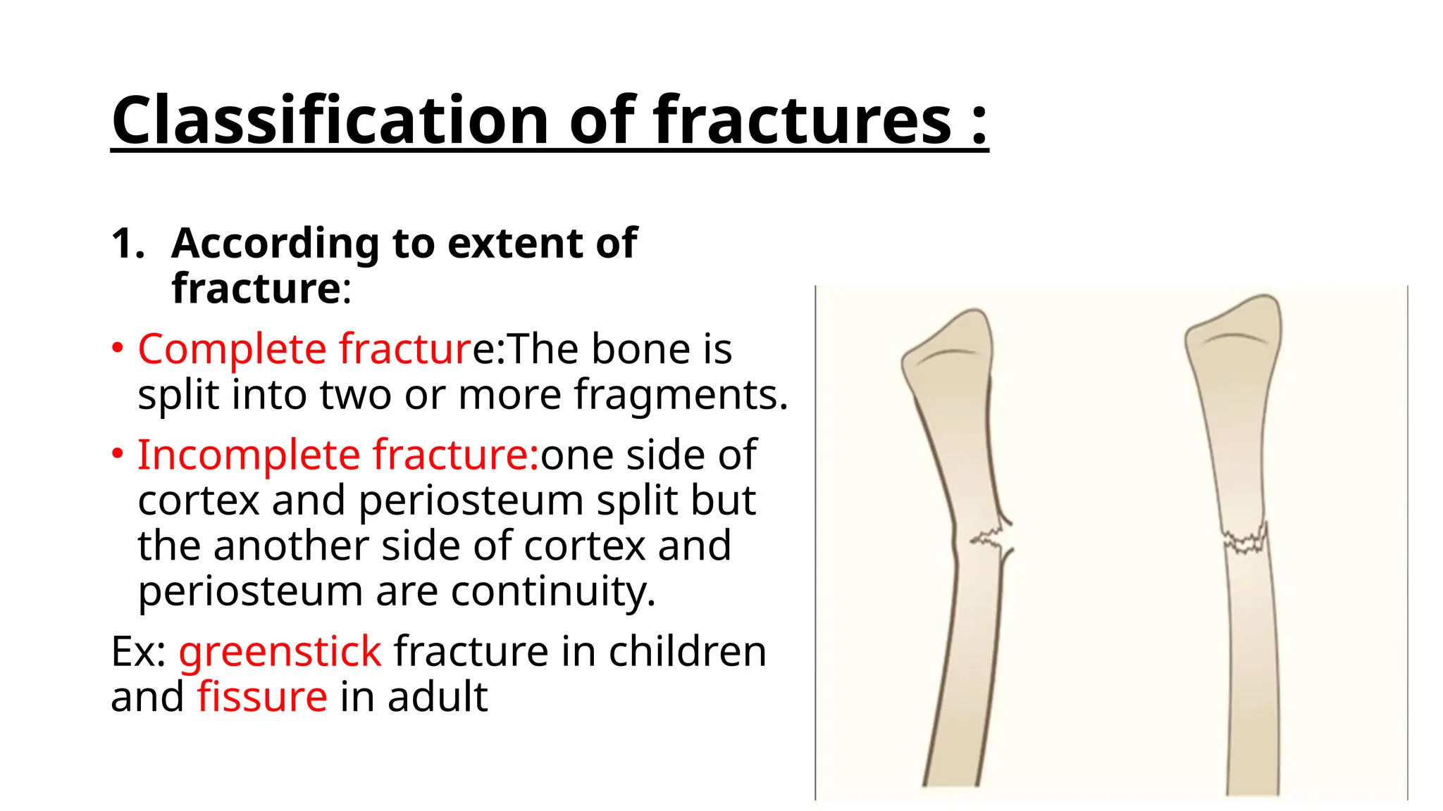 general. principles of fractures.pptx