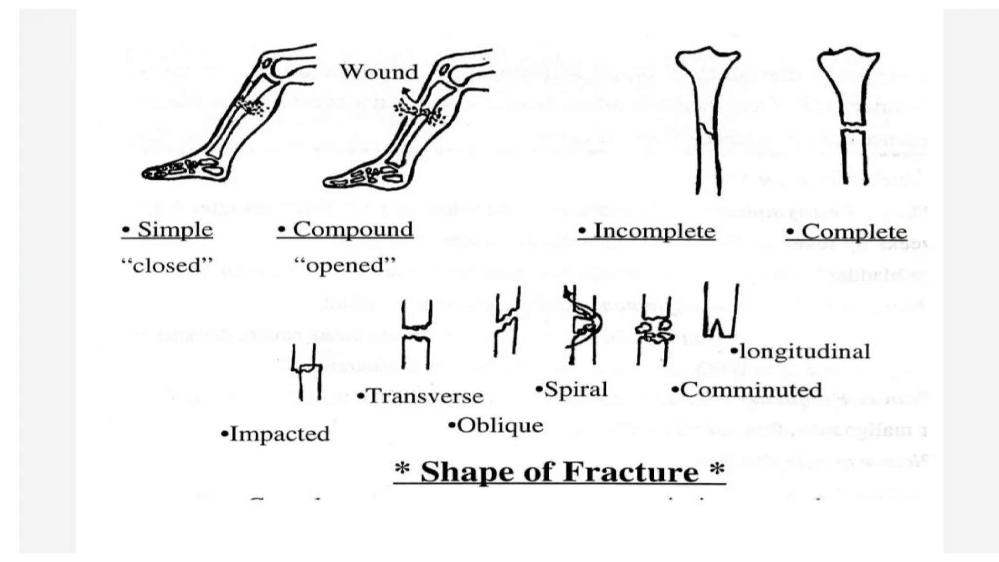 general. principles of fractures.pptx