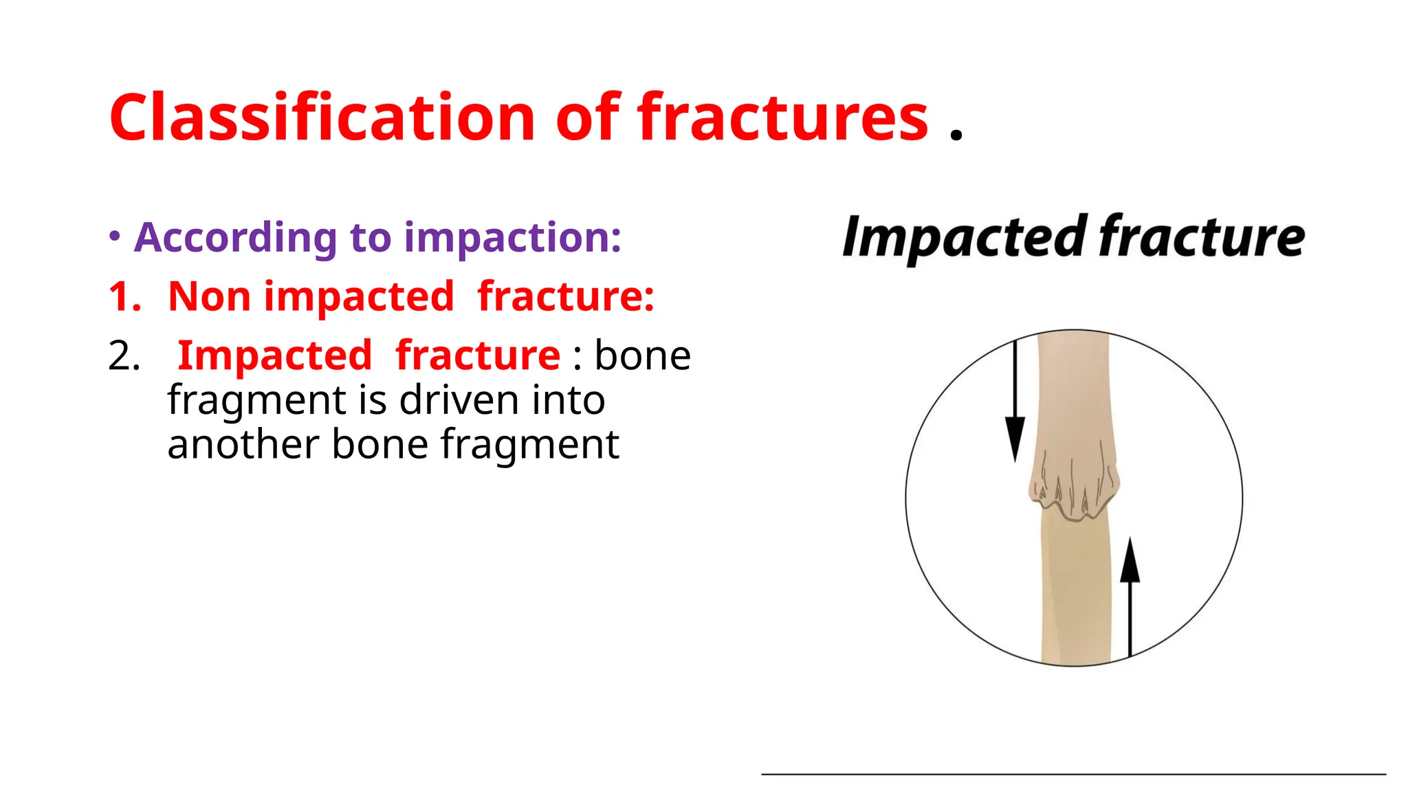general. principles of fractures.pptx