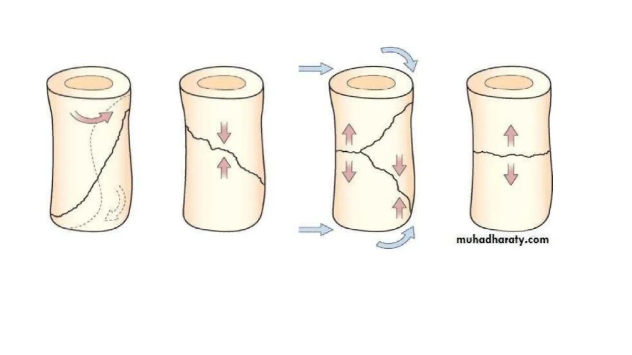 general. principles of fractures.pptx