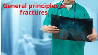 general. principles of fractures.pptx