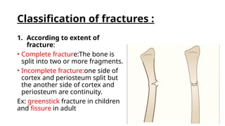 general. principles of fractures.pptx