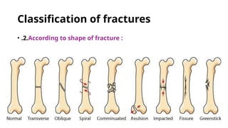 general. principles of fractures.pptx