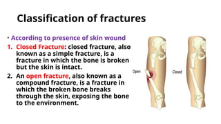 general. principles of fractures.pptx