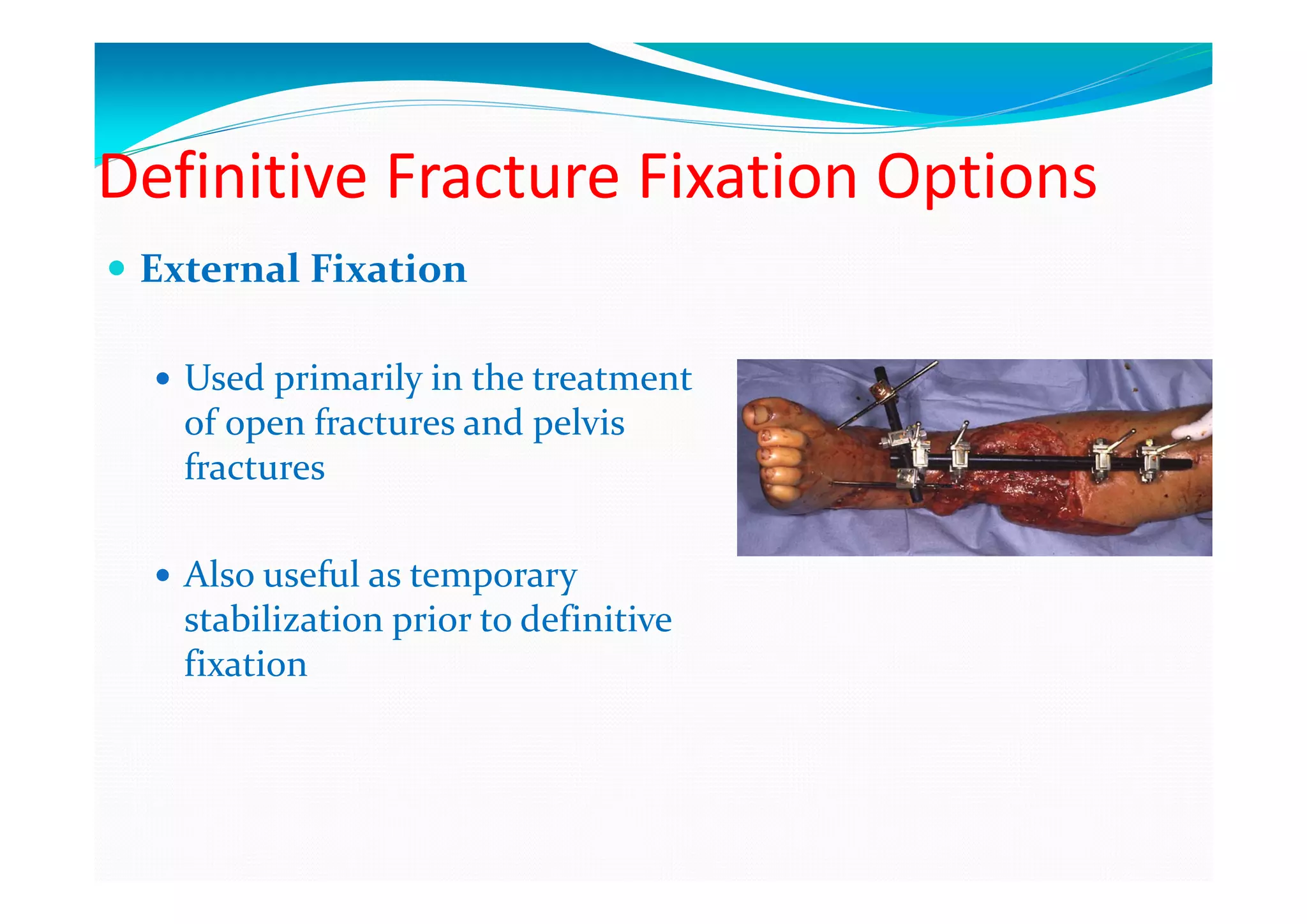 General principles of fractures treatment 1.pdf